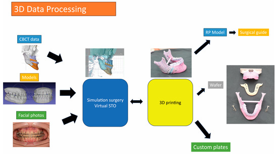 Advancements in Oral Maxillofacial Surgery: A Comprehensive Review on ...