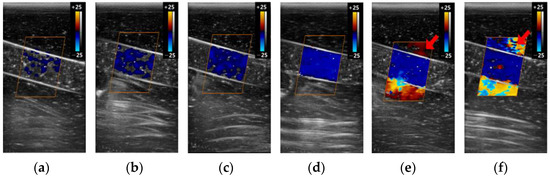 Development and Evaluation of Doppler Ultrasound Training Phantom for ...