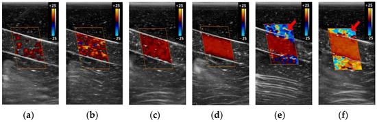 Development and Evaluation of Doppler Ultrasound Training Phantom for ...