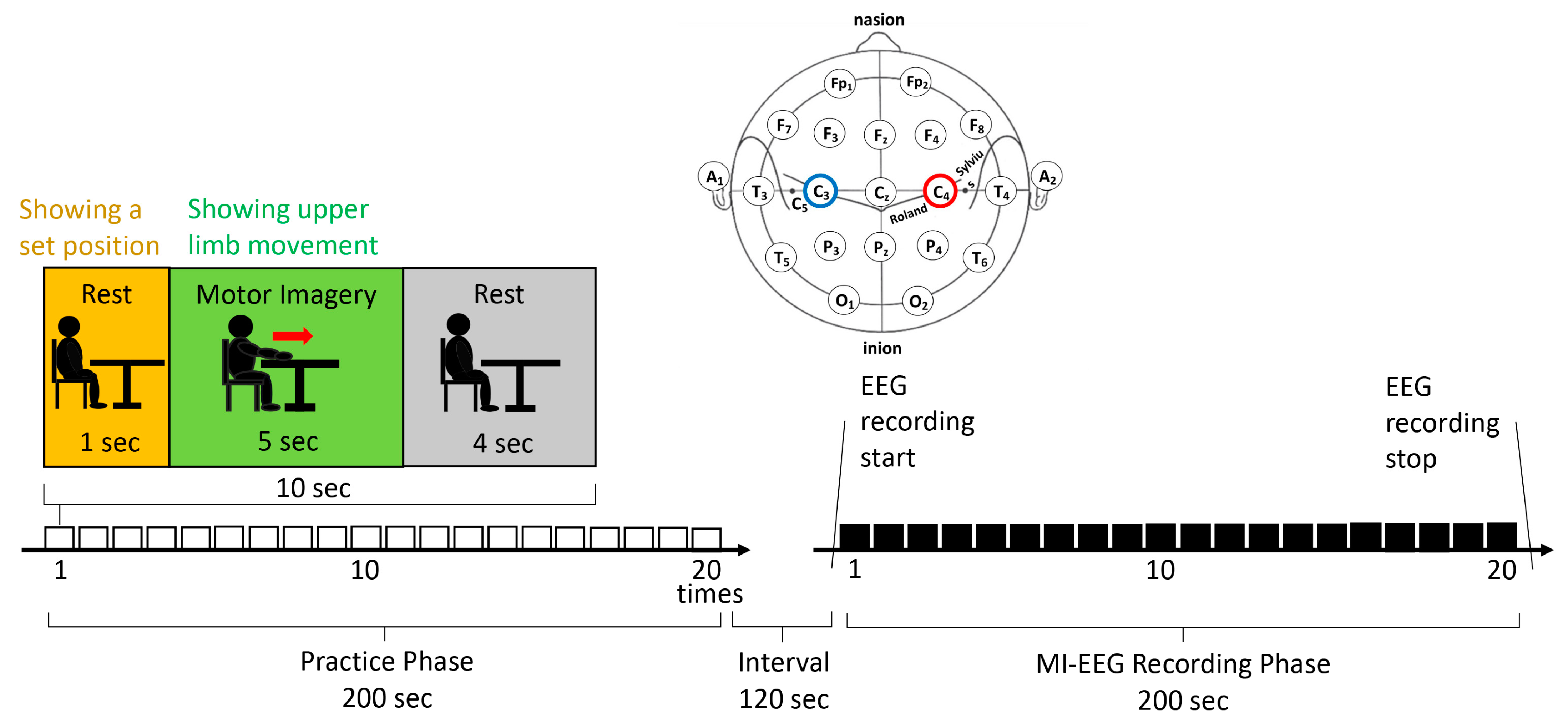 Development of an Application That Implements a Brain–Computer Interface to an Upper-Limb Motor ...