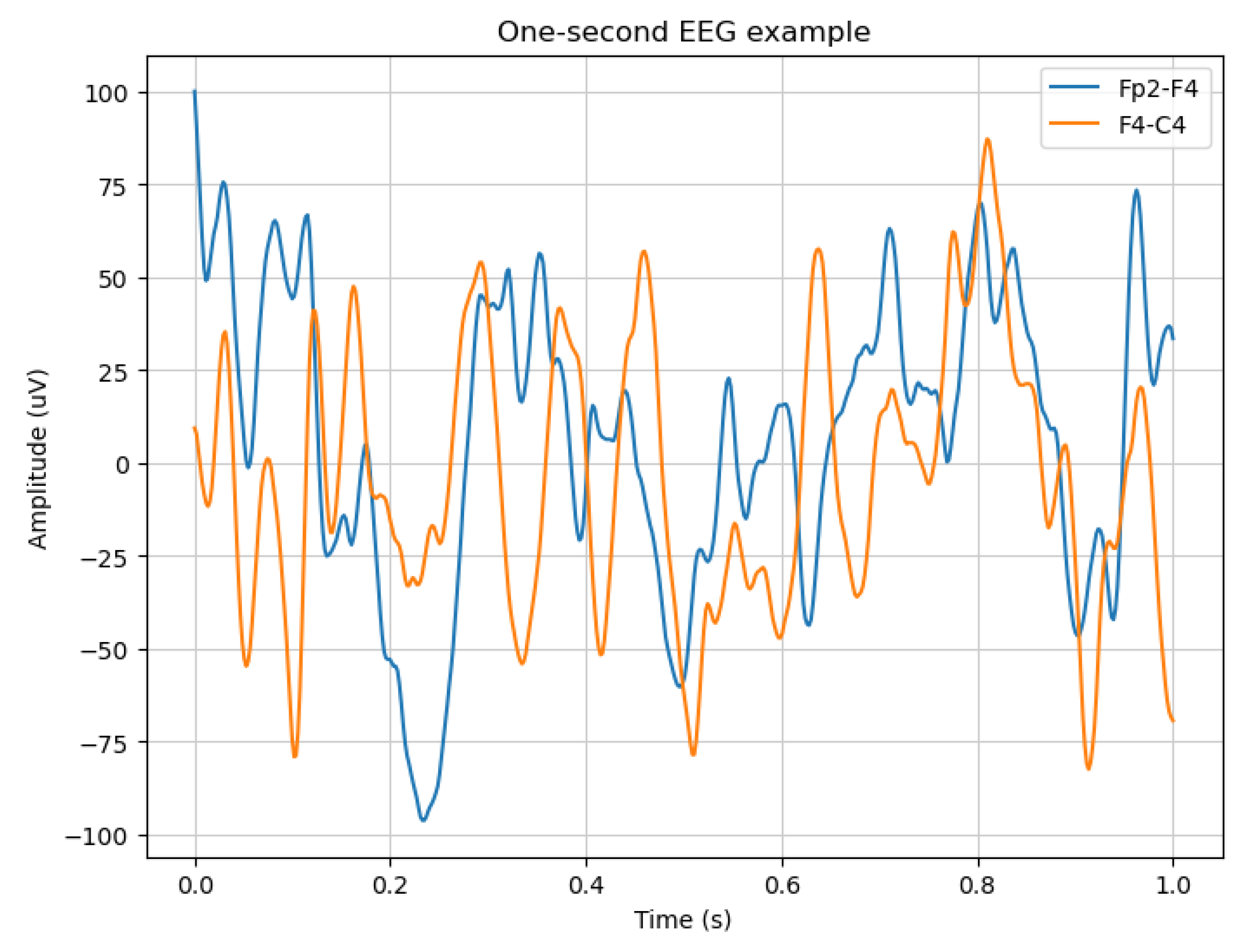 Applied Sciences | Free Full-Text | Distributional Representation of Cyclic Alternating Patterns ...