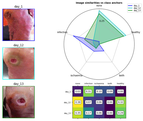 DFU-Helper: An Innovative Framework for Longitudinal Diabetic Foot ...
