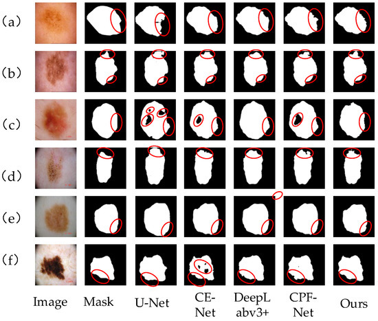 Applied Sciences | Free Full-Text | MSREA-Net: An Efficient Skin ...