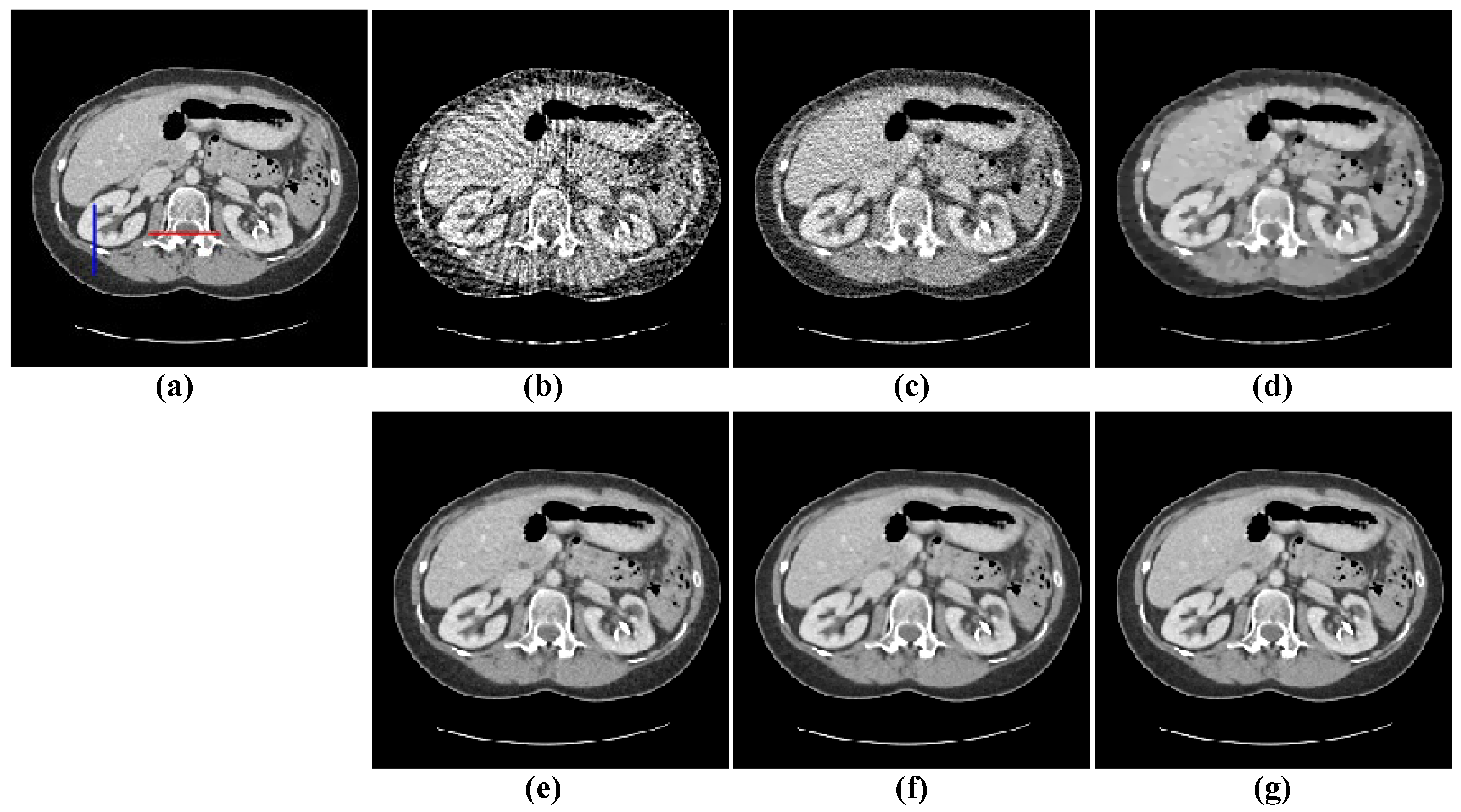 Applied Sciences Free Full Text Sparse View Computed Tomography Reconstruction Based On A