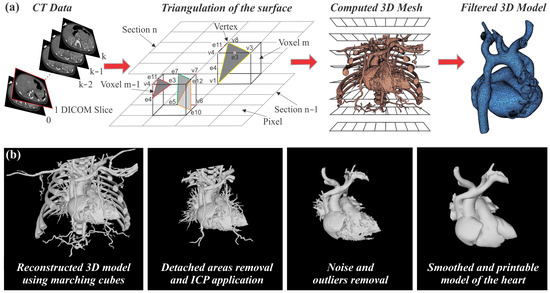 Examination of a Human Heart Fabricating Its 3D-Printed Cardiovascular Model and Employing ...