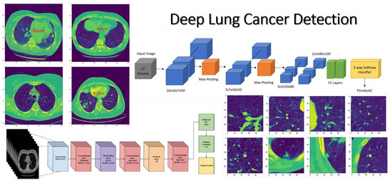 Applying Deep Learning to Medical Imaging: A Review