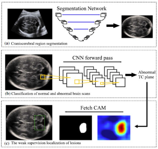 Applying Deep Learning to Medical Imaging: A Review