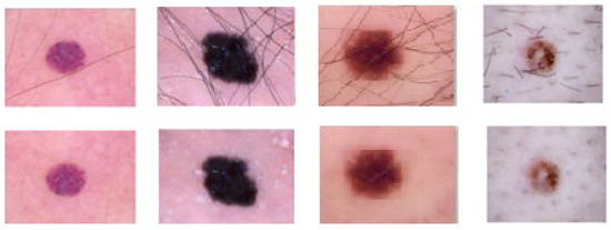 Performance Improvement of Melanoma Detection Using a Multi-Network System Based on Decision Fusion