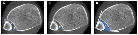 Ins and Outs of the Ankle Syndesmosis from a 2D to 3D CT Perspective