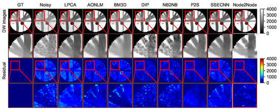 Node2Node: Self-Supervised Cardiac Diffusion Tensor Image Denoising Method