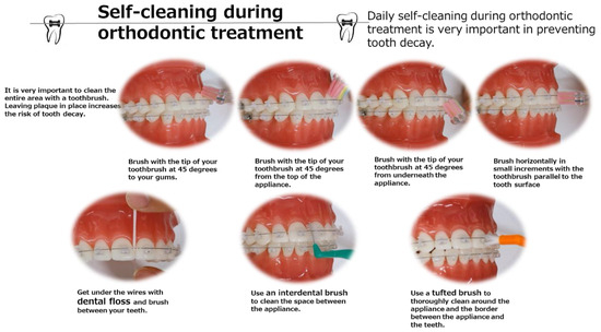 An Observational Study on Changes in the Oral and Gut Microbiota ...