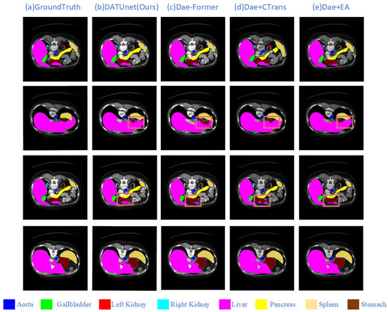 A Multi-Scale Cross-Fusion Medical Image Segmentation Network Based on Dual-Attention Mechanism ...