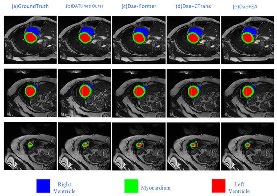 A Multi-Scale Cross-Fusion Medical Image Segmentation Network Based on Dual-Attention Mechanism ...