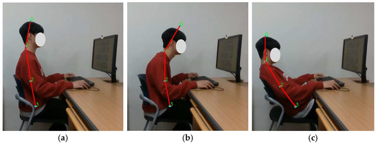 Classifying Poor Postures of the Neck and Spine in Computer Work by ...