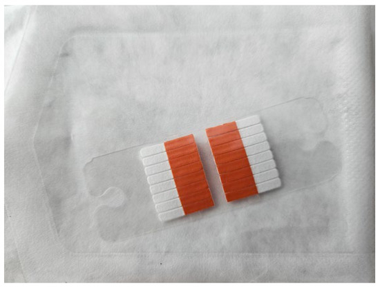 Expression of C Reactive Protein in Gingival Crevicular Fluid of ...