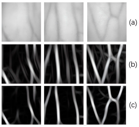 U-Net-Embedded Gabor Kernel and Coaxial Correction Methods to Dorsal ...