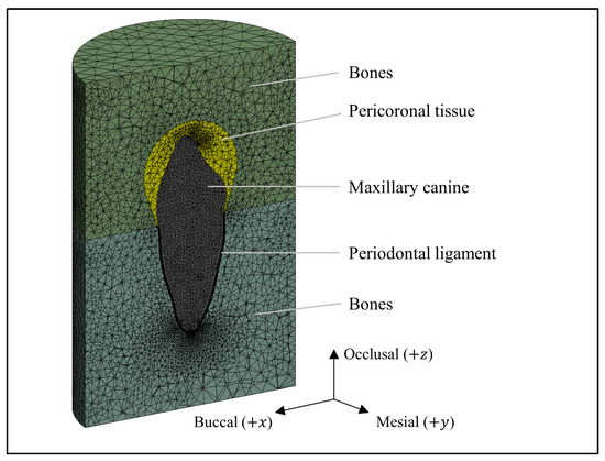 The Center of Resistance of an Impacted Maxillary Canine: A Finite ...