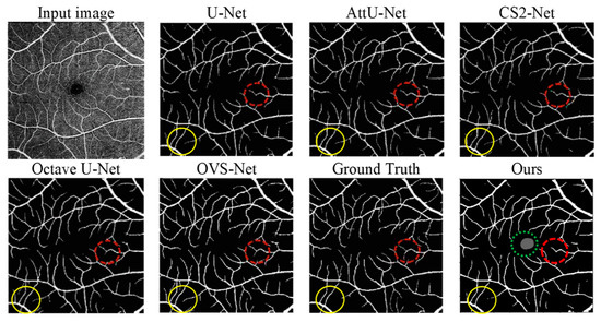 Adaptive Deep Clustering Network for Retinal Blood Vessel and Foveal ...