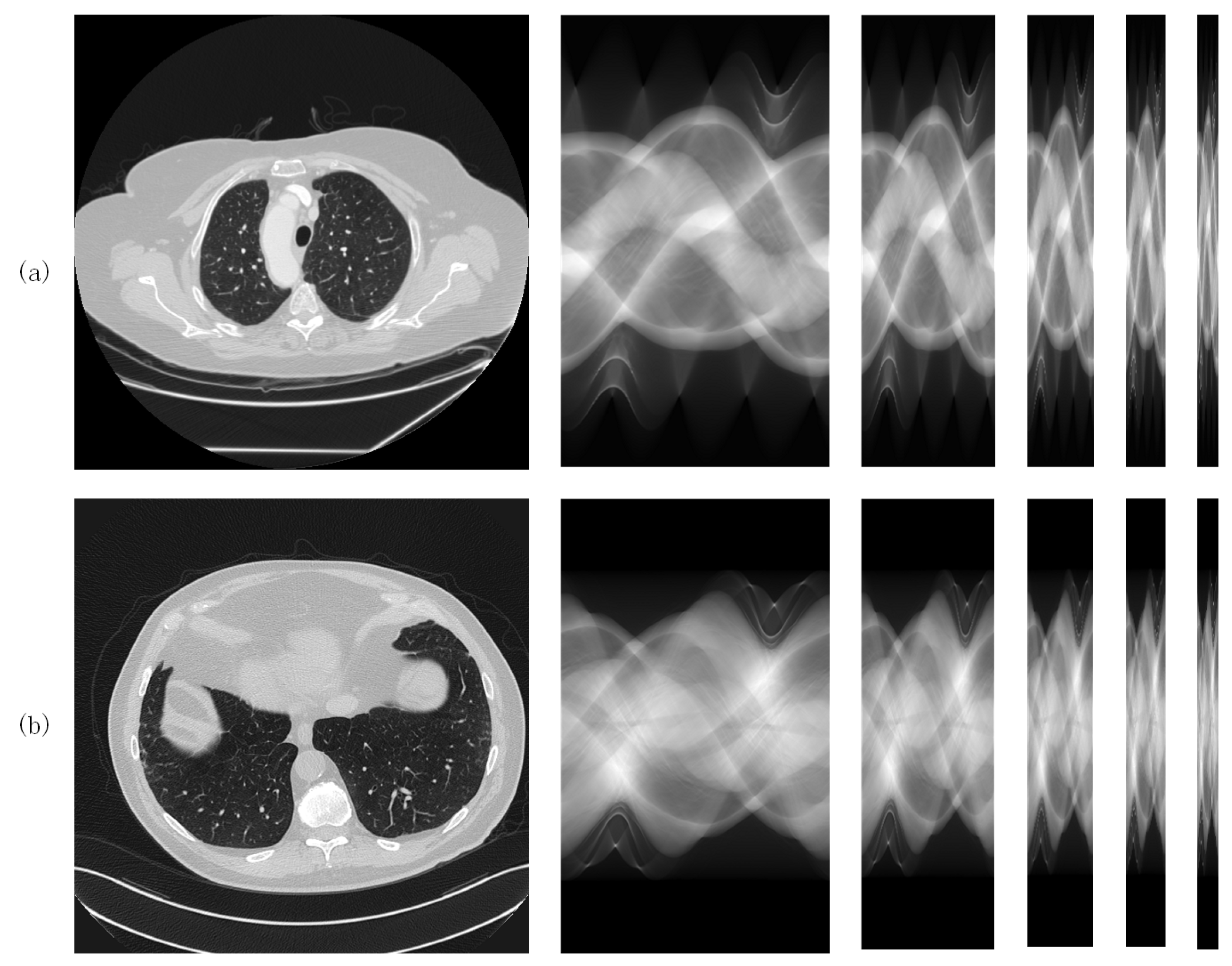 An Efficient Sinogram Domain Fully Convolutional Interpolation Network For Sparse View Computed