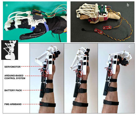 Soft, Rigid, and Hybrid Robotic Exoskeletons for Hand Rehabilitation ...