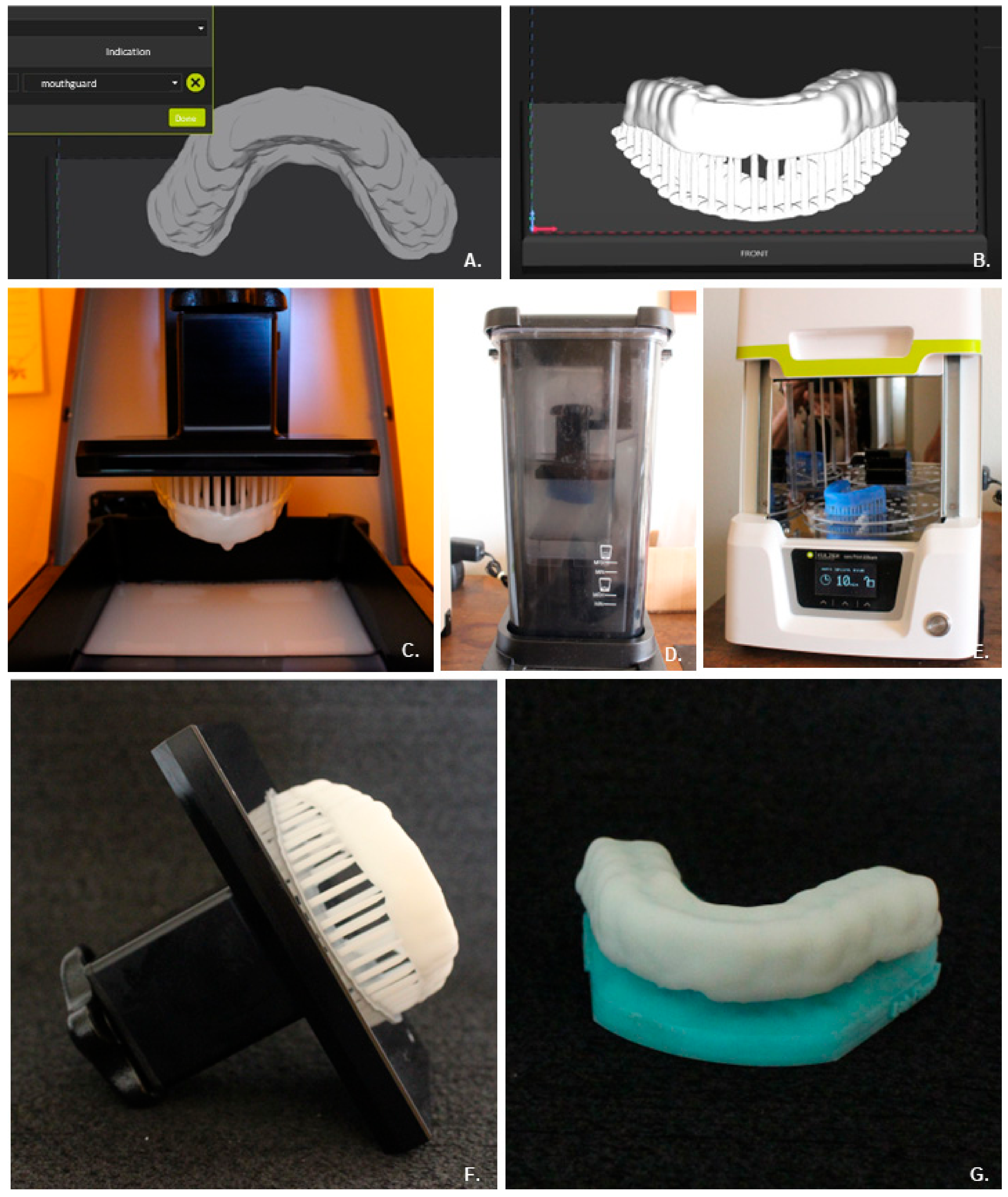 Ergonomic Sports Mouthguards: A Narrative Literature Review and Future ...