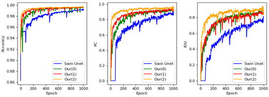 A Fabric Defect Segmentation Model Based on Improved Swin-Unet with Gabor Filter