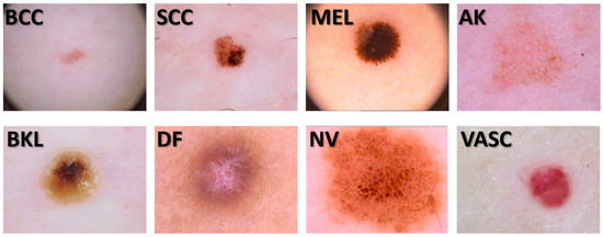 Applied Sciences | Free Full-Text | Classification of Skin Lesion ...
