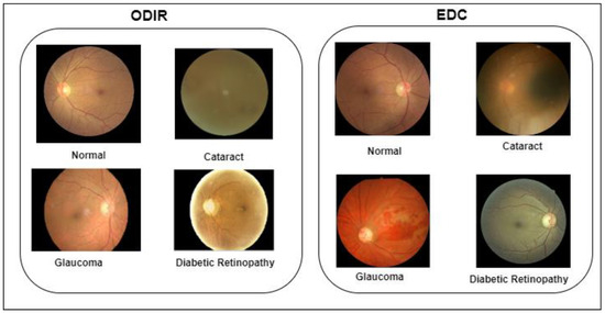 Artificial Intelligence-Driven Eye Disease Classification Model