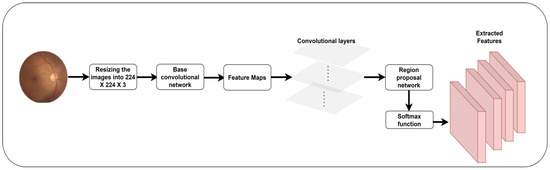 Artificial Intelligence-Driven Eye Disease Classification Model