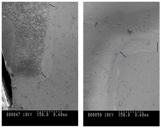 Marginal Discrepancy and Internal Fit of Bi-Layered and Monolithic ...