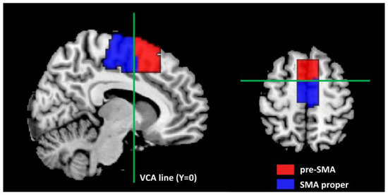 Effective Connectivity Changes among Brain Hierarchical Architecture of ...