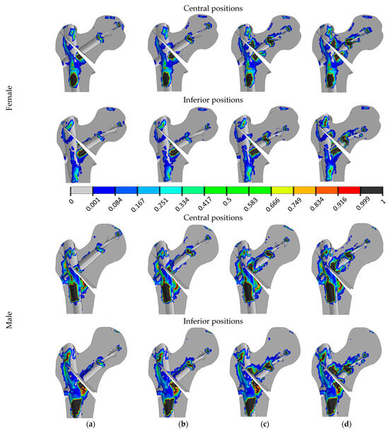 Damage-Based Assessment of the Risk of Cut-Out in Trochanteric ...