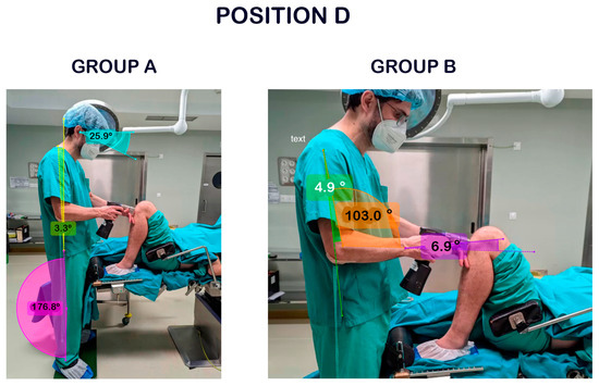 Ergonomic Evaluation of Different Surgeon Positions for Total Knee ...