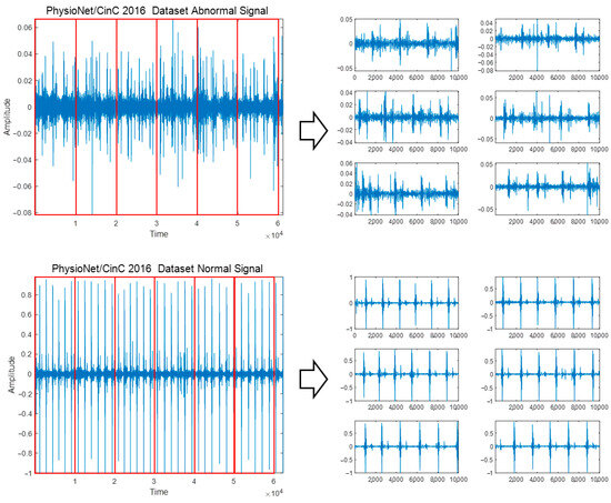 Heart Sound Classification Using Wavelet Analysis Approaches and ...
