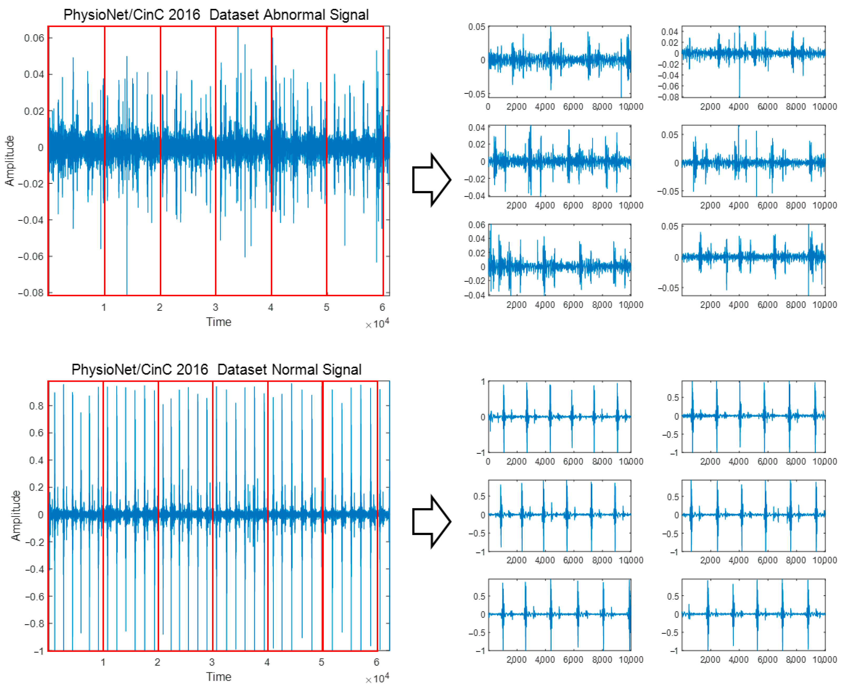 Applied Sciences | Free Full-Text | Heart Sound Classification Using Wavelet Analysis Approaches ...