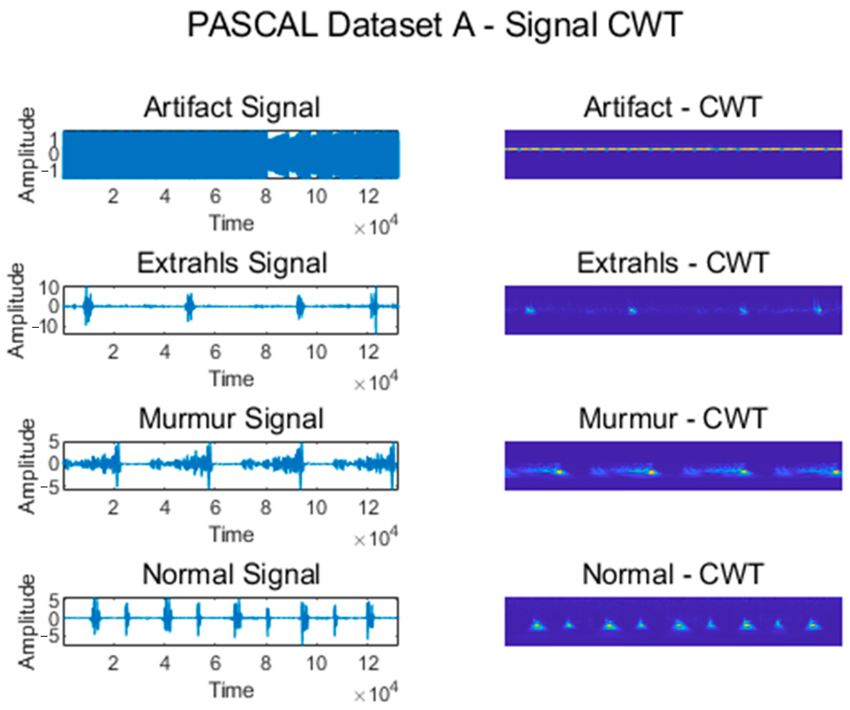 Applied Sciences | Free Full-Text | Heart Sound Classification Using Wavelet Analysis Approaches ...