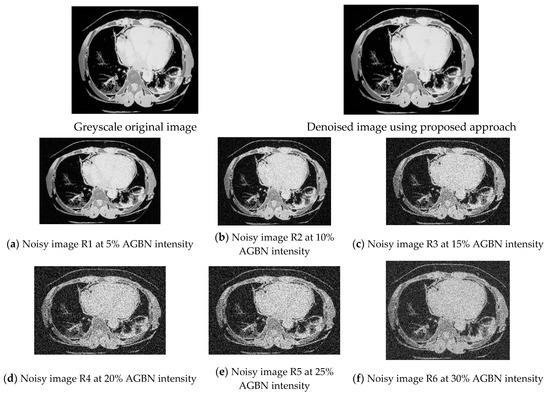 An Image Denoising Technique Using Wavelet-Anisotropic Gaussian Filter-Based Denoising ...