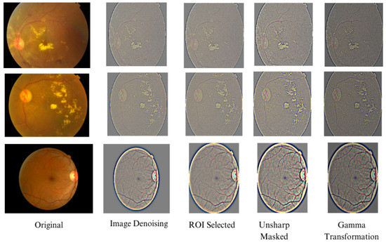 Applied Sciences | Free Full-Text | Toward Lightweight Diabetic ...