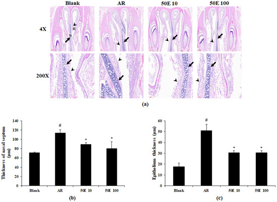 Effects of Thymus quinquecostatus Celakovski on Allergic Responses in ...