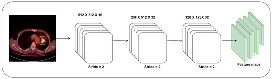 Lung Cancer Detection Model Using Deep Learning Technique