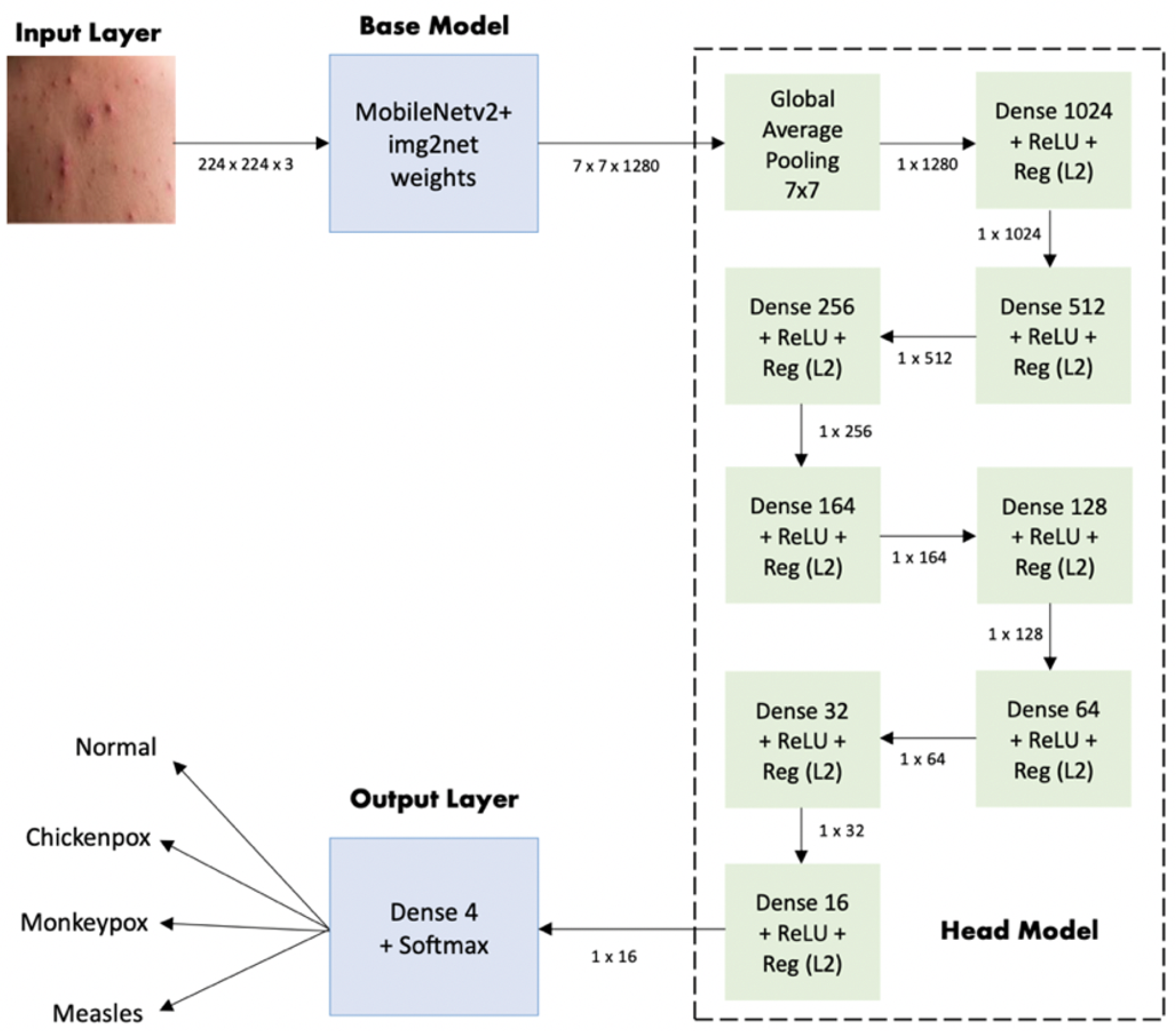 Applied Sciences | Free Full-Text | A Deep Learning-Based Mobile Application for Monkeypox Detection