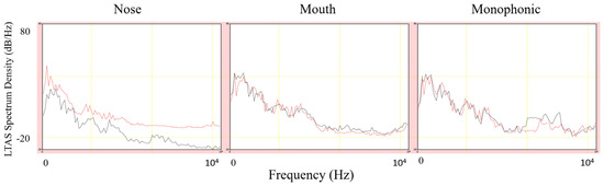 Applied Sciences | Free Full-Text | Unmasking Nasality to Assess ...