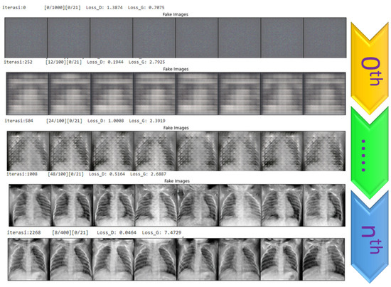 Hybrid Deep Convolutional Generative Adversarial Network (DCGAN) and ...