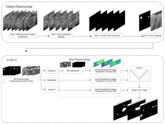 Detection of Cavities from Dental Panoramic X-ray Images Using Nested U-Net Models