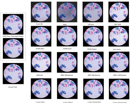 Applied Sciences | Free Full-Text | Multi-Focus Microscopy Image Fusion ...