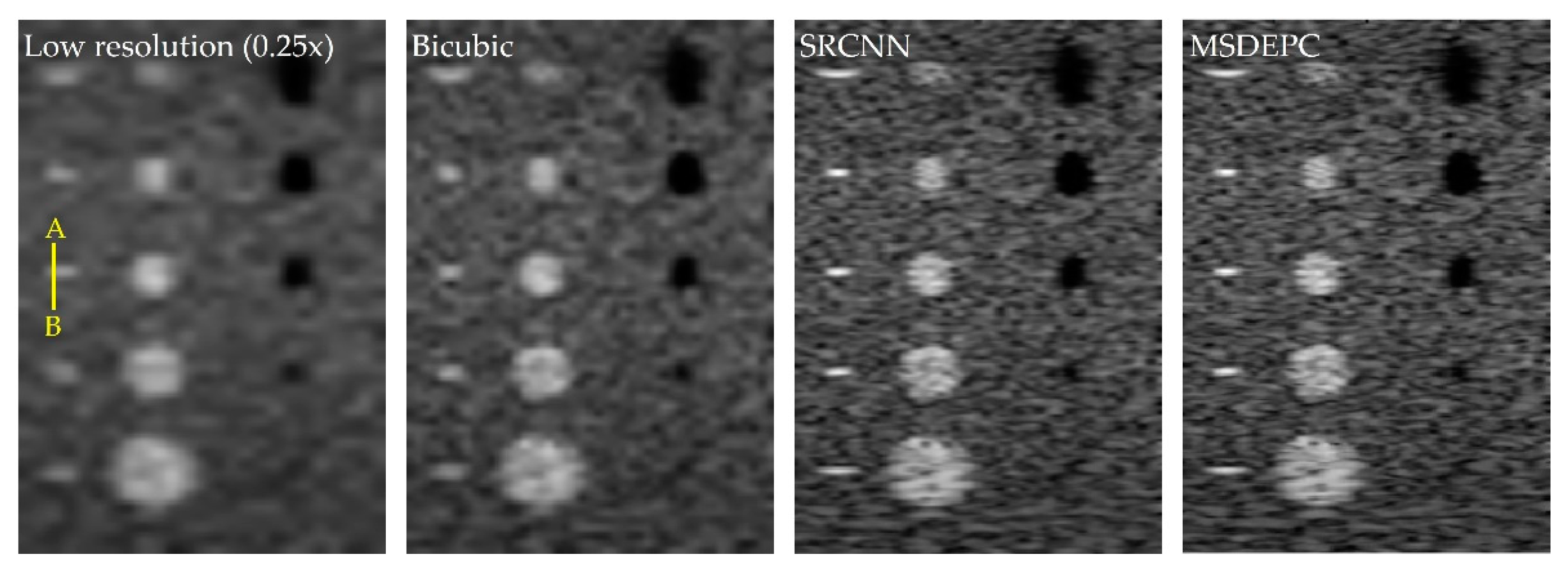 A Multiscale Deep Encoder–Decoder with Phase Congruency Algorithm Based on Deep Learning for ...