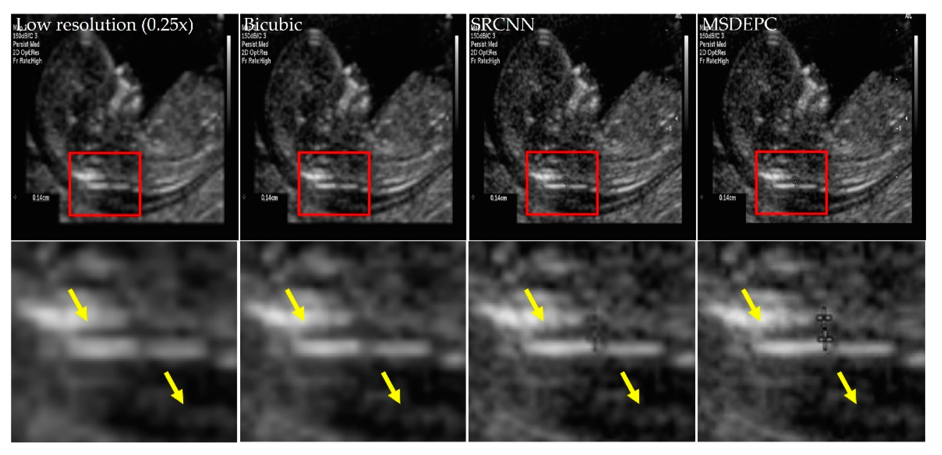 A Multiscale Deep Encoderdecoder With Phase Congruency Algorithm Based On Deep Learning For