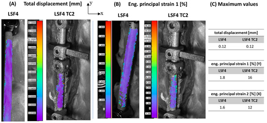 Biomechanical Analysis of the Impact of Transverse Connectors of ...