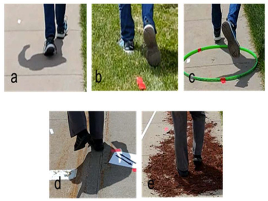 Deep-Learning-Based Approach for Automated Detection of Irregular ...