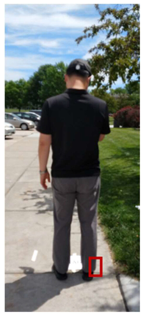 Deep-Learning-Based Approach for Automated Detection of Irregular ...